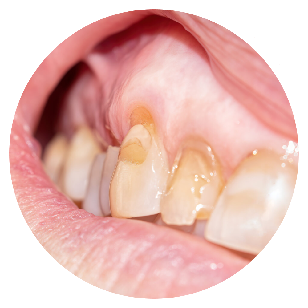 Dr Wyman Chan London – Invisalign Dentist Sibu, Sarawak