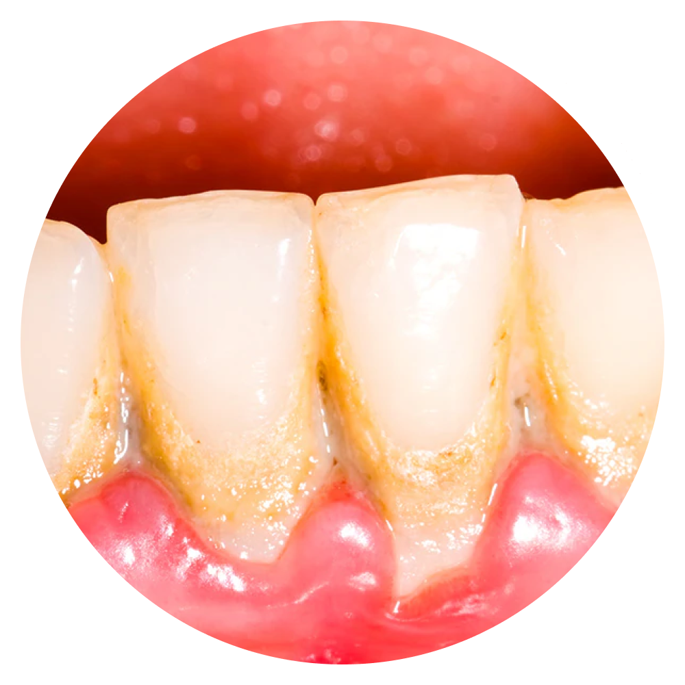 Dr Wyman Chan London – Invisalign Dentist Sibu, Sarawak