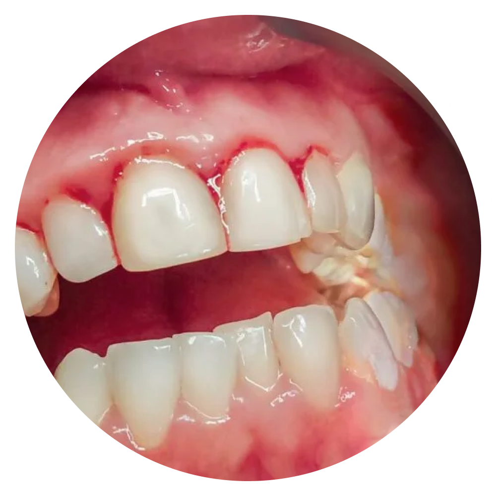 Dr Wyman Chan London – Invisalign Dentist Sibu, Sarawak