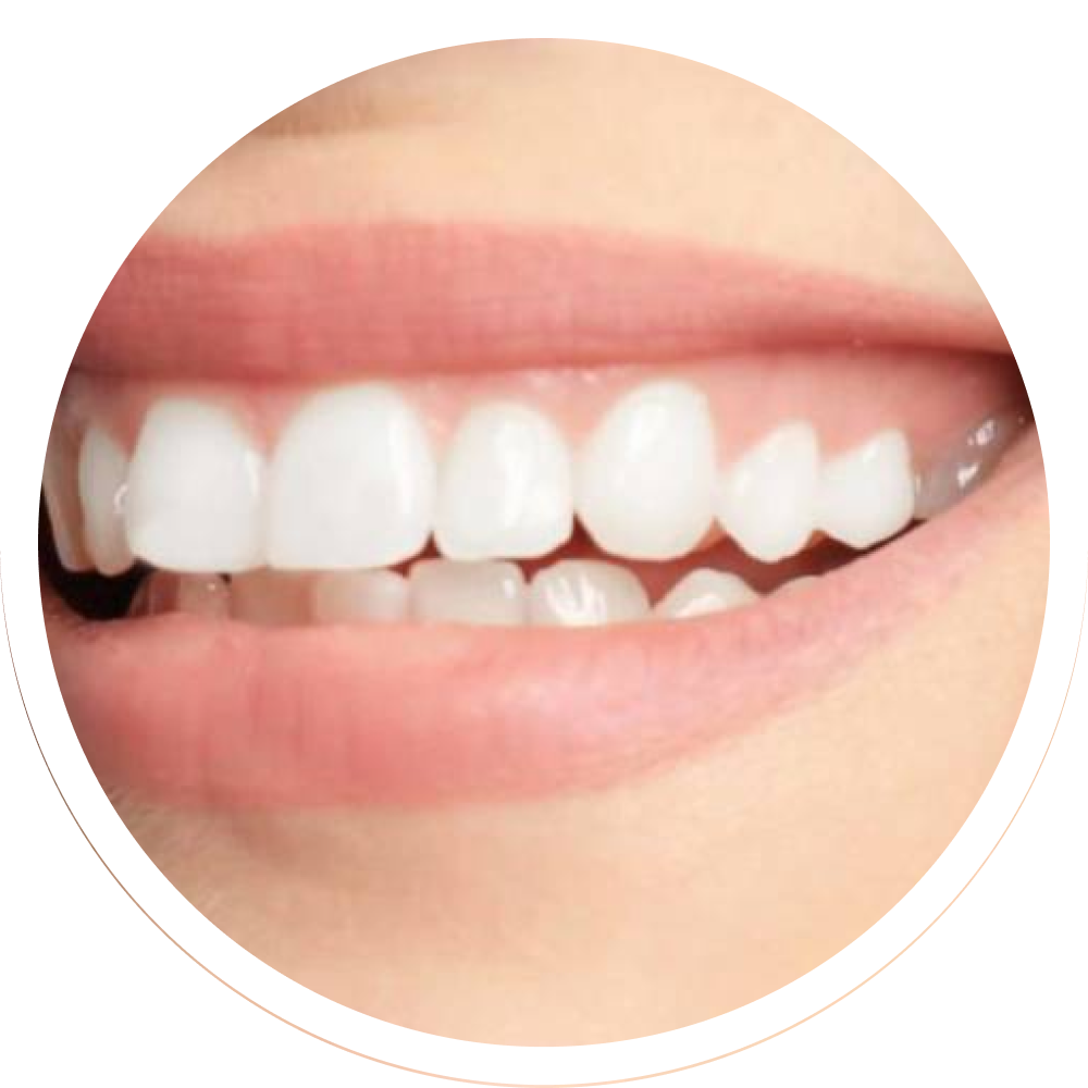 cosmetic gum surgery – Invisalign Dentist Sibu, Sarawak